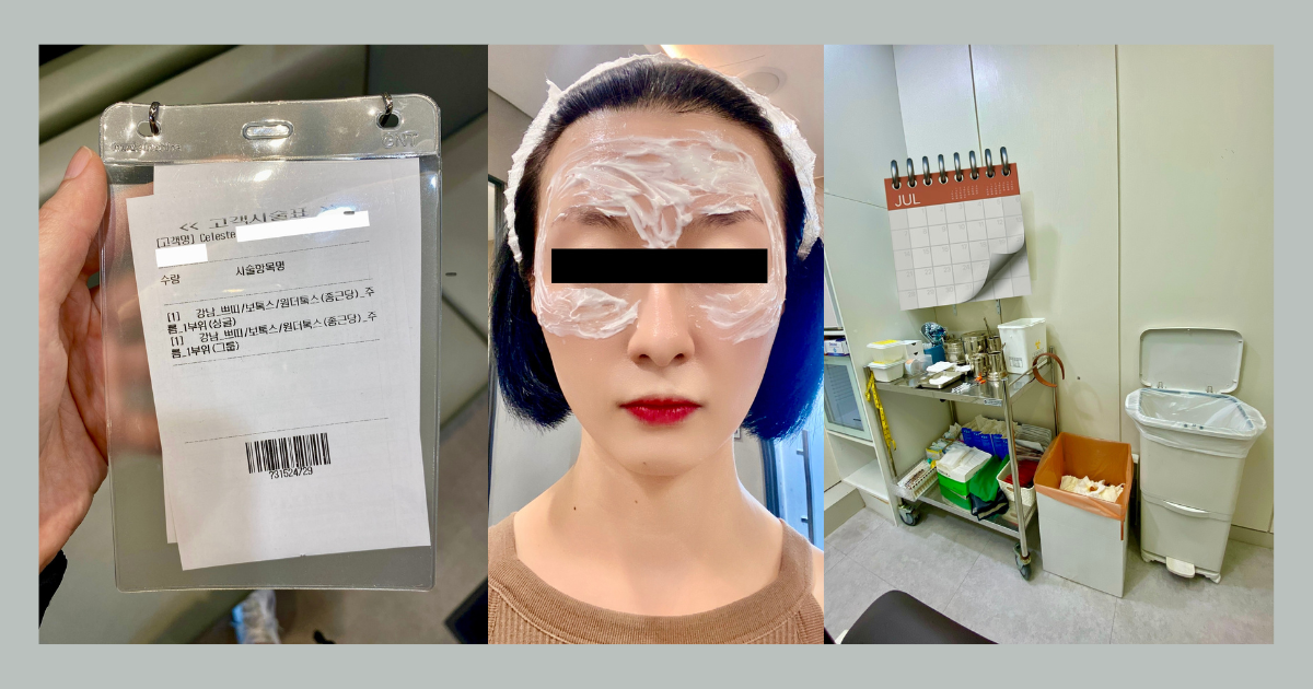 It’s been 4 months since my 40.10 SGD Korean botox injections in South ...